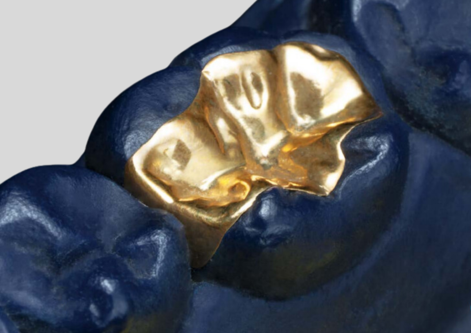 Lab Prosthetics – Modern Dental Laboratory SG